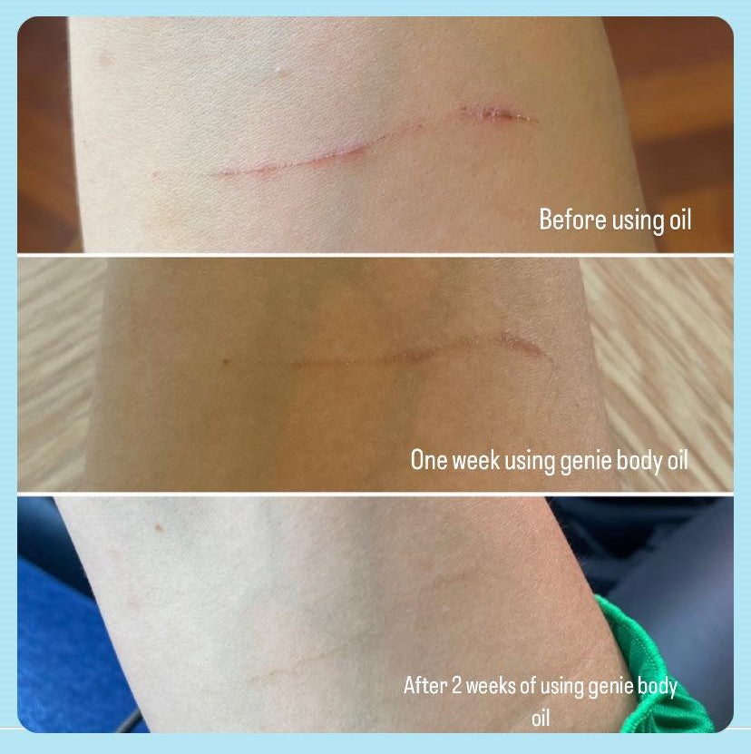 genie body & skin – genie body & skin
